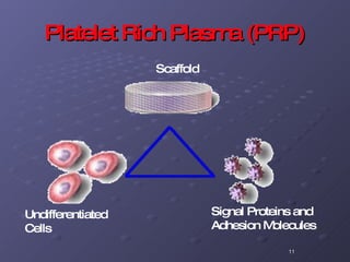 Prp Matrix Grafts | PPT