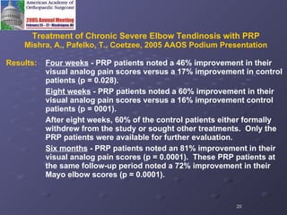 Prp Matrix Grafts | PPT