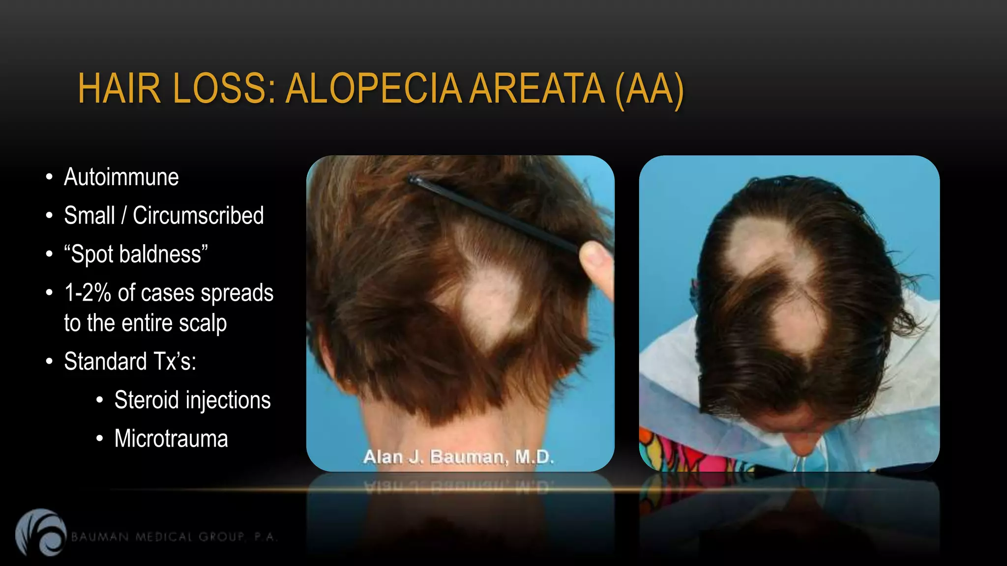 PRP Platelet Rich Plasma for Hair Regrowth by Dr. Alan Bauman | PPTX