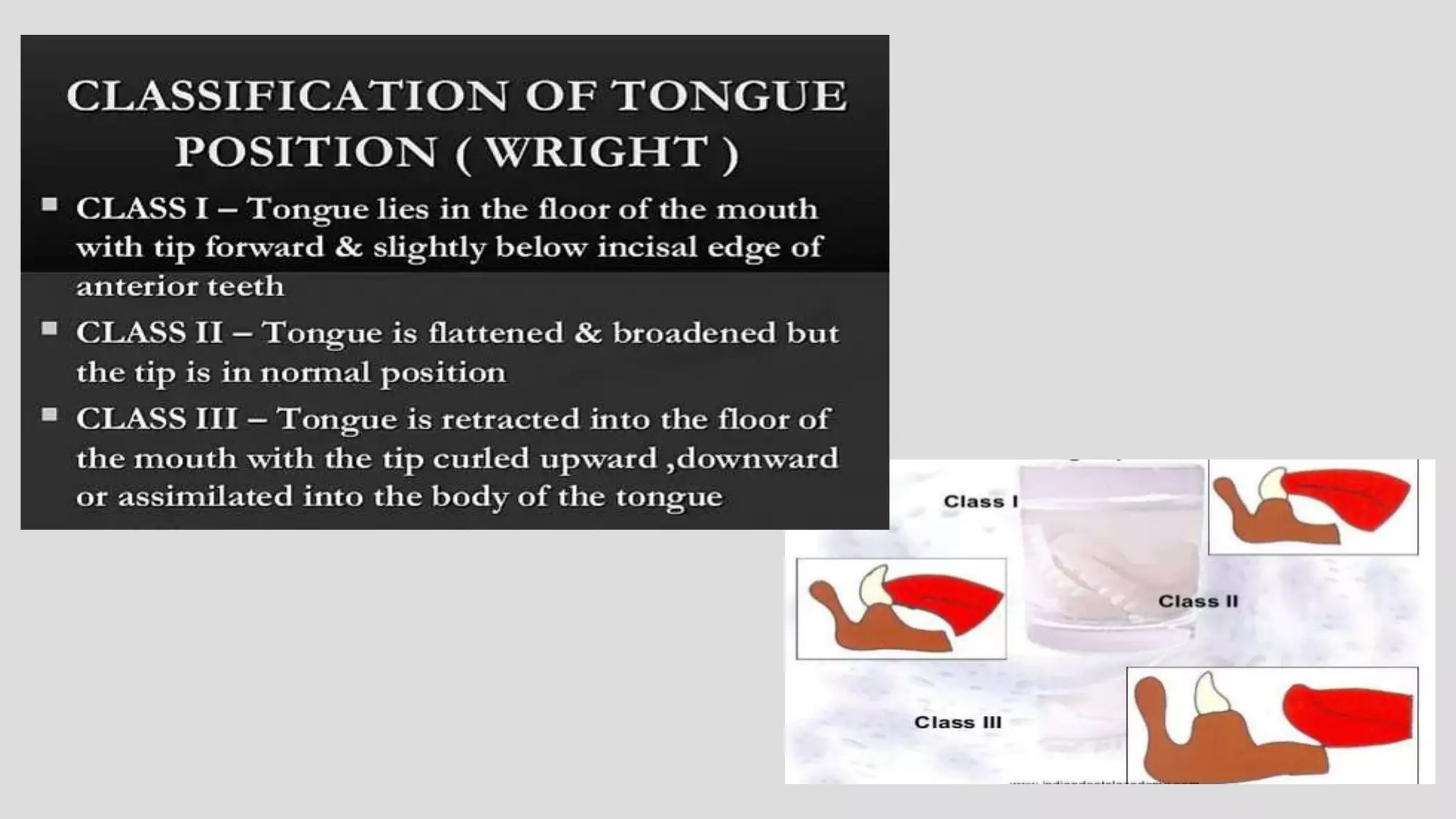 HISTORY AND EXAMINATION IN PROSTHODONTICS | PPTX