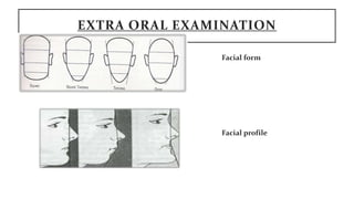 HISTORY AND EXAMINATION IN PROSTHODONTICS | PPTX