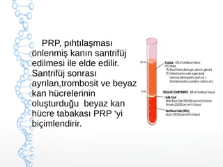 PRP (Platelet-Rich Plasma) | ODP