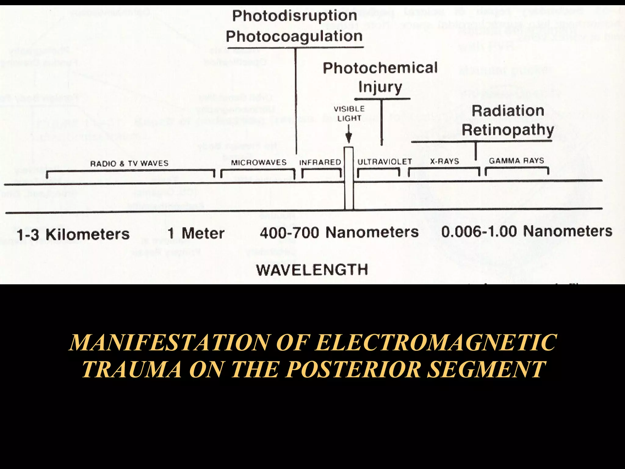 Radiation Injuries To Eye | PPT