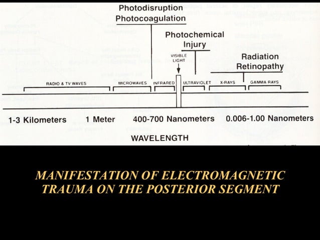 Radiation Injuries To Eye | PPT | Eye and Vision Conditions | Diseases ...