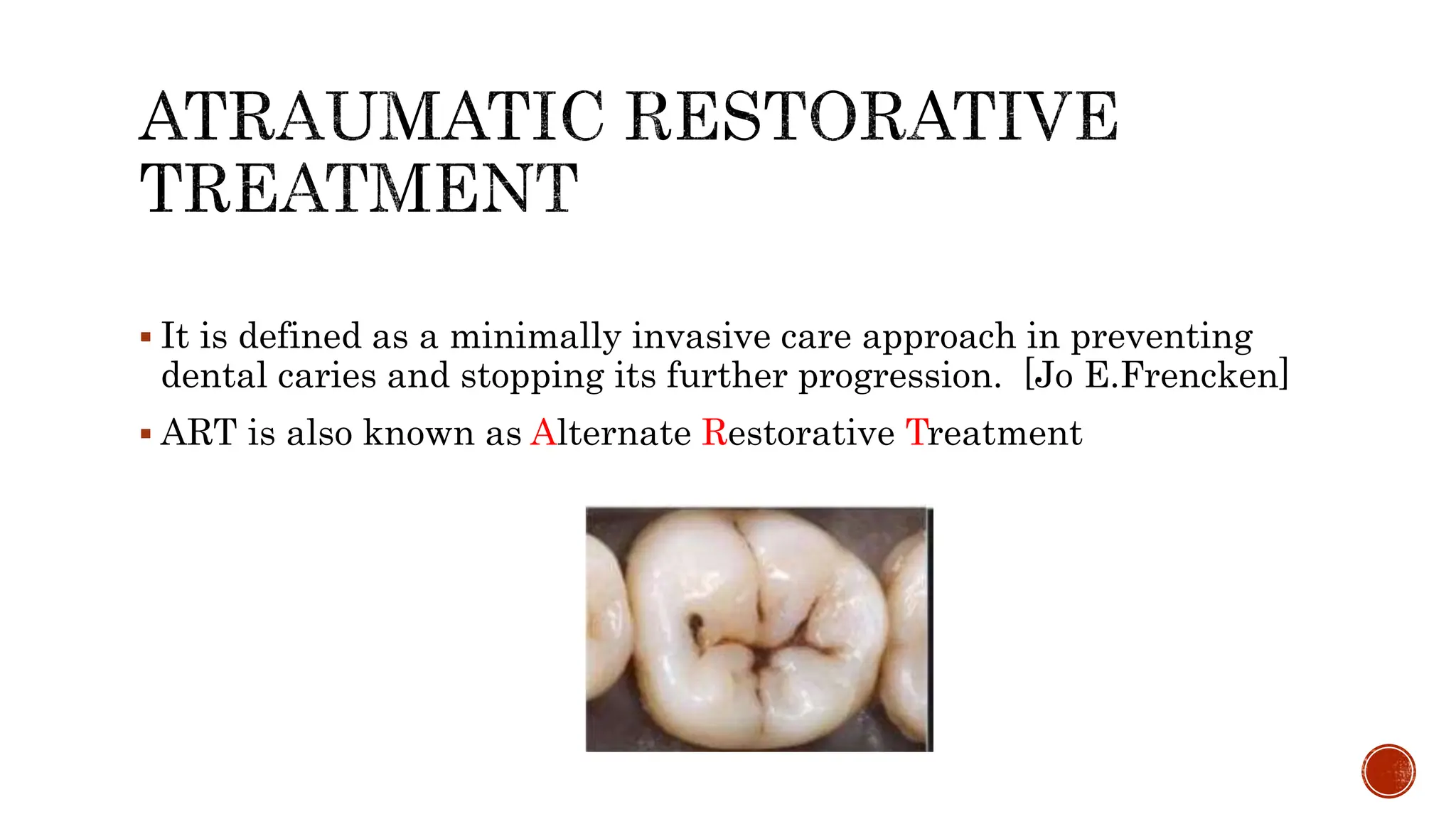 Atraumatic restoration technique and preservative restoration technique ...
