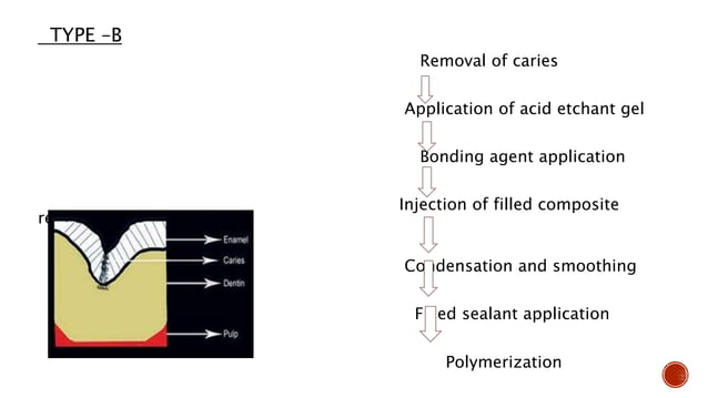 Atraumatic restoration technique and preservative restoration technique ...