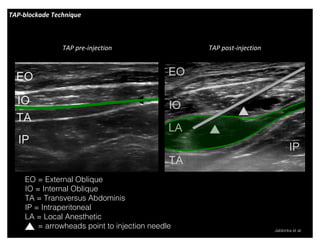 prs_140_2_2017_05_22_smith_prsd1602135_sdc1.pdf