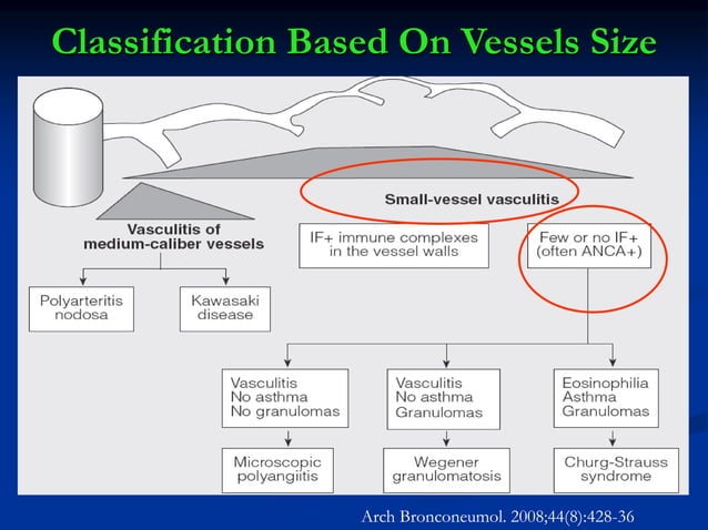 Pulmonary Renal Syndorme | PPT | Blood Disorders | Diseases and Conditions