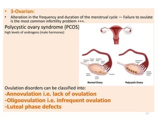infertility | PPTX