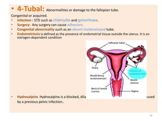 infertility | PPTX