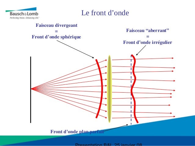 Présentation aberromètre