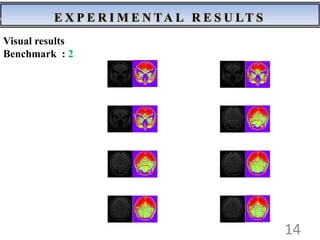 Medical Image Segmentation Using Hidden Markov Random Field A Distributed Approach | PPT