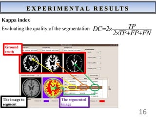 Medical Image Segmentation Using Hidden Markov Random Field A Distributed Approach | PPT