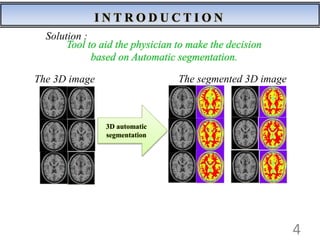 Medical Image Segmentation Using Hidden Markov Random Field A Distributed Approach | PPT
