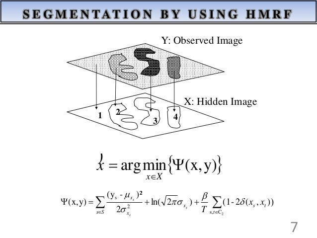 Medical Image Segmentation Using Hidden Markov Random Field A Distri
