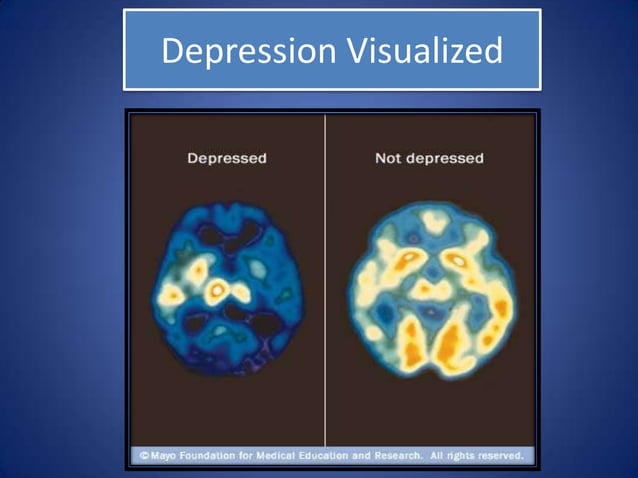 Psychopharmacology Lect 1 Overview | PPT Psychopharmacology Lect 1 Overview | PPT