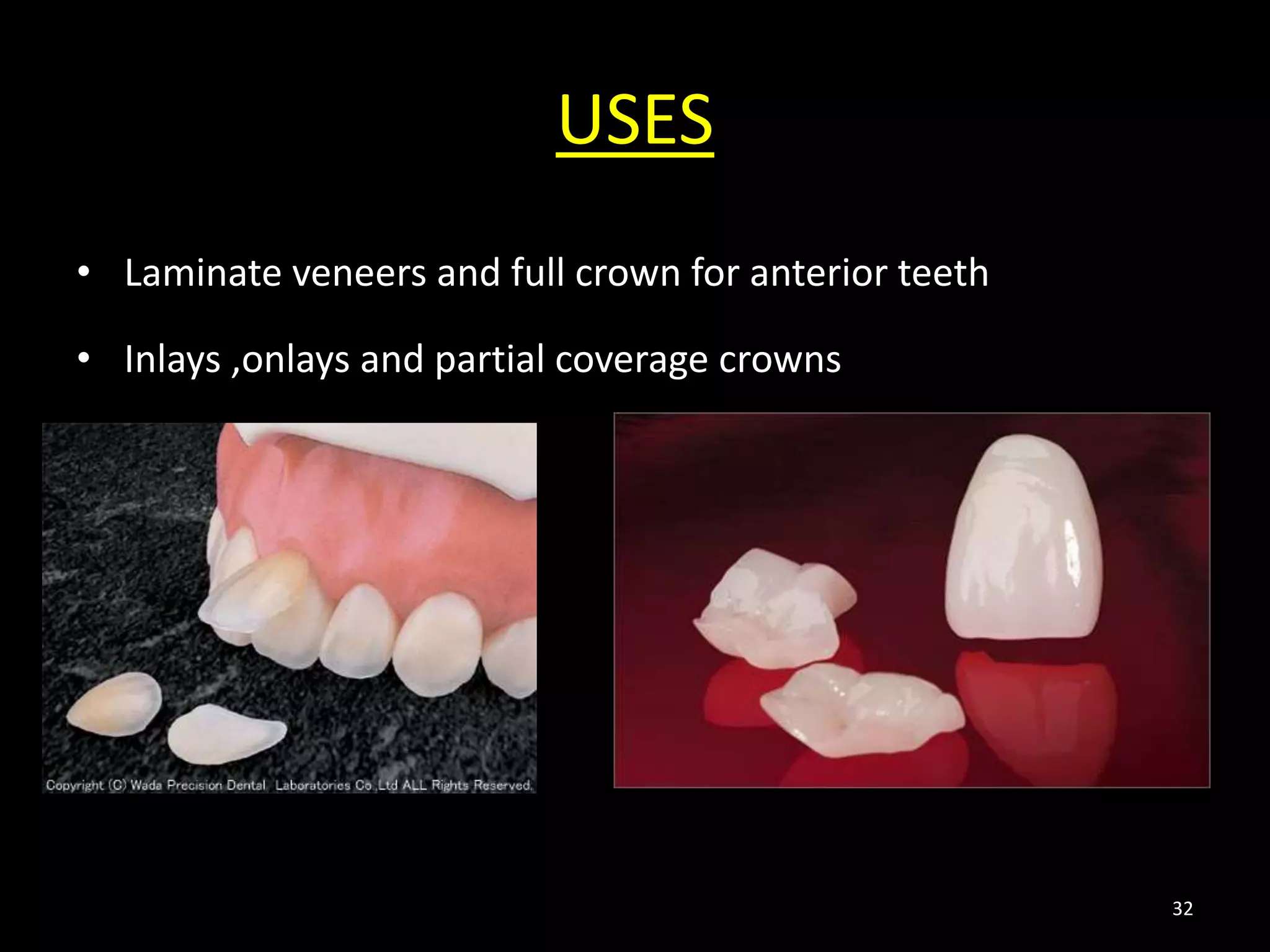 Pressable ceramics | PPTX