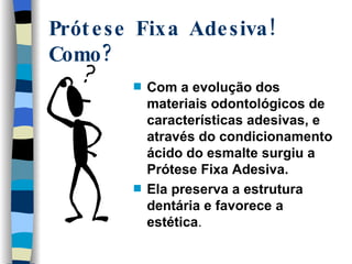 Prótese fixa adesiva 2 | PPT