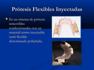 Prótesis dentales-flexible | PPT
