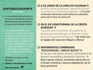 Prótesis parcial removible | PPTX