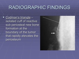 osteosarcoma | PPTX