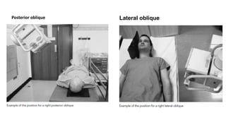 PRT position section 1(Dr.Aya Ali).pptx