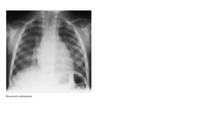 PRT position section 1(Dr.Aya Ali).pptx