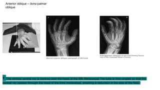 PRT position section 1(Dr.Aya Ali).pptx