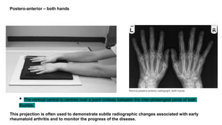 PRT position section 1(Dr.Aya Ali).pptx