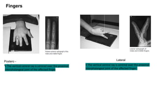 PRT position section 1(Dr.Aya Ali).pptx