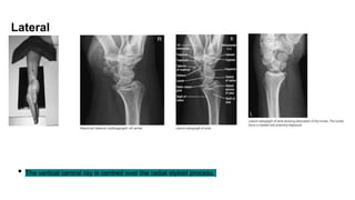 PRT position section 1(Dr.Aya Ali).pptx