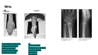 PRT position section 1(Dr.Aya Ali).pptx