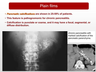 Chronic Pancreatitis X Ray