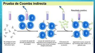 Prueba de-coombs | PPTX