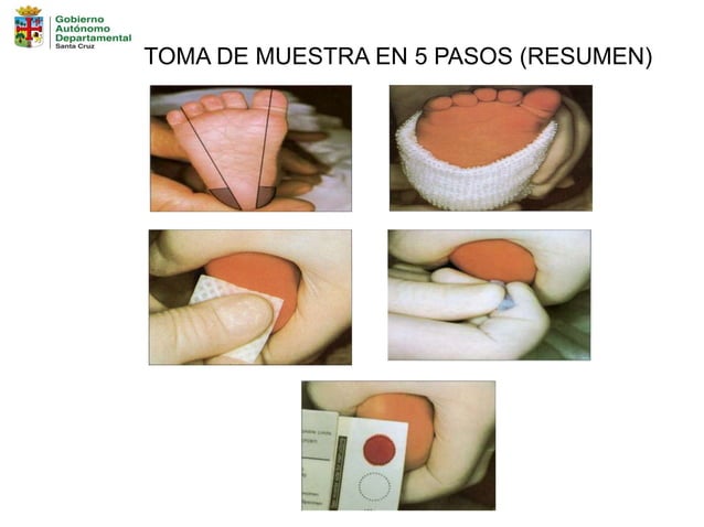 Prueba del talon | PPTX