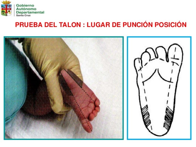 Prueba del talon