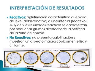 Prueba de RPR | PPT