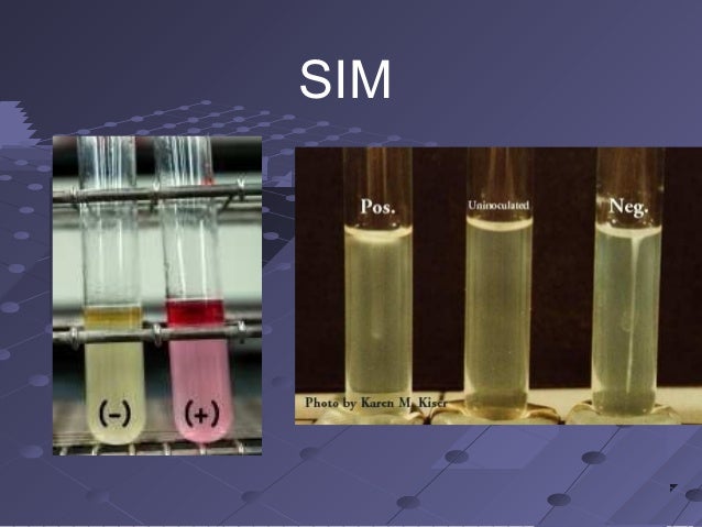 Pruebas.bioquimicas.de.identificacion.243338506