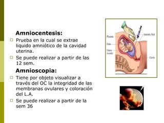 Pruebas bienestar fetal - DZCH.pptx