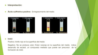 Pruebas bioquimicas para enterobacterias | PPTX