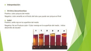 Pruebas bioquimicas para enterobacterias | PPTX