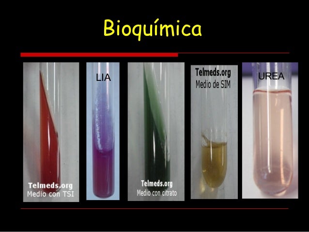 Pruebas bioquimicas en Enterobacterias
