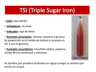 Prueba Tsi Microbiología