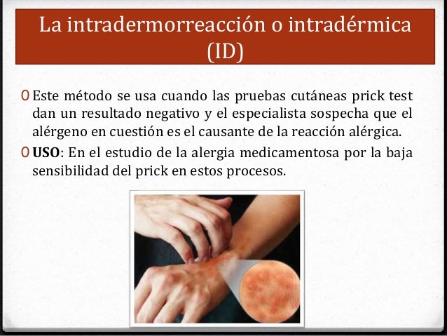 En Que Consisten Las Pruebas De La Alergia Pruebas De La Alergia, ¿en