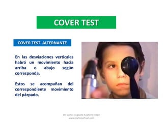 Pruebas De Alineacion Ocular | PPTX