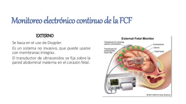 Pruebas de bienestar fetal
