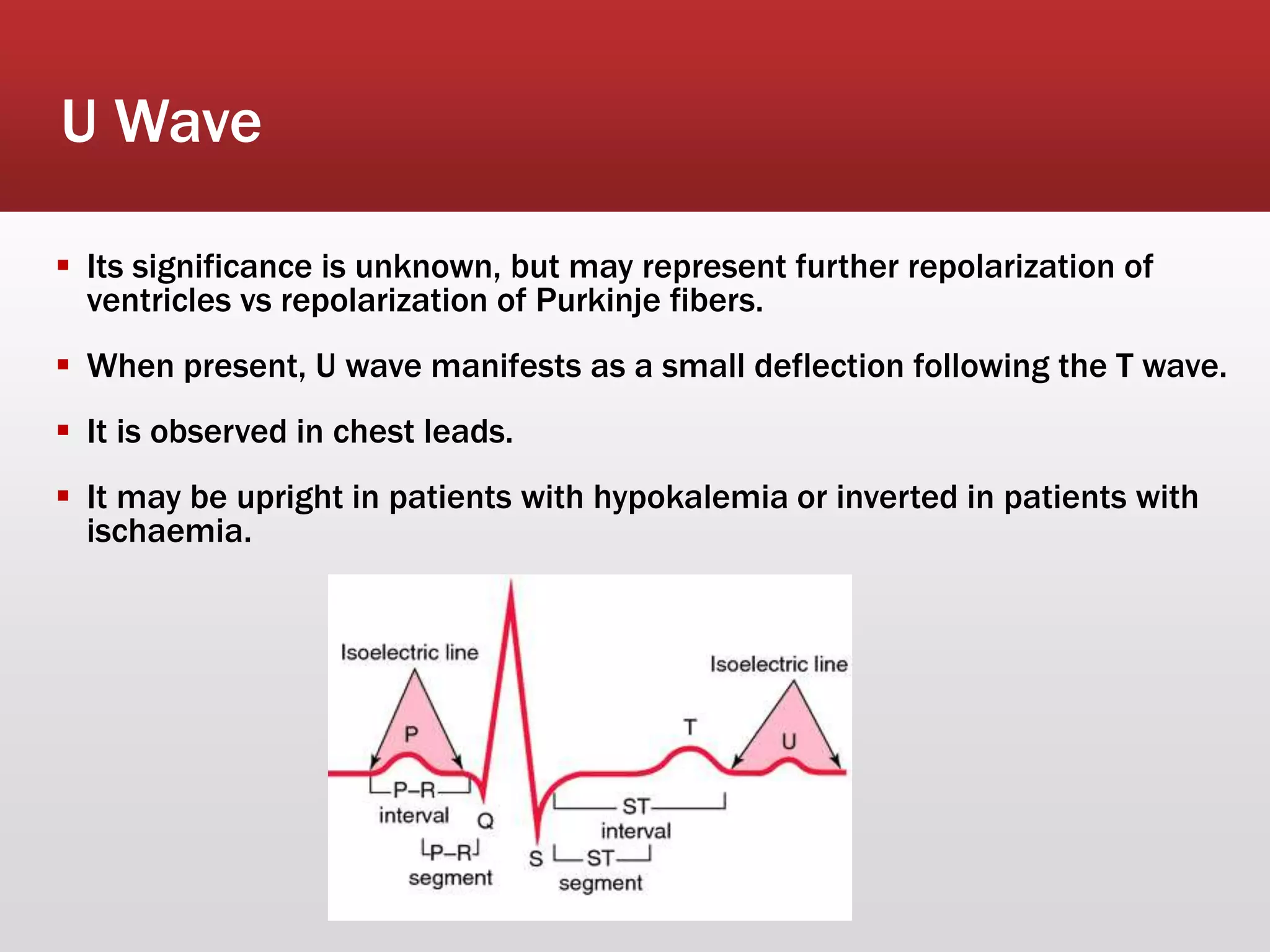 ECG BASICS AND ARRTHYMIAS | PPTX