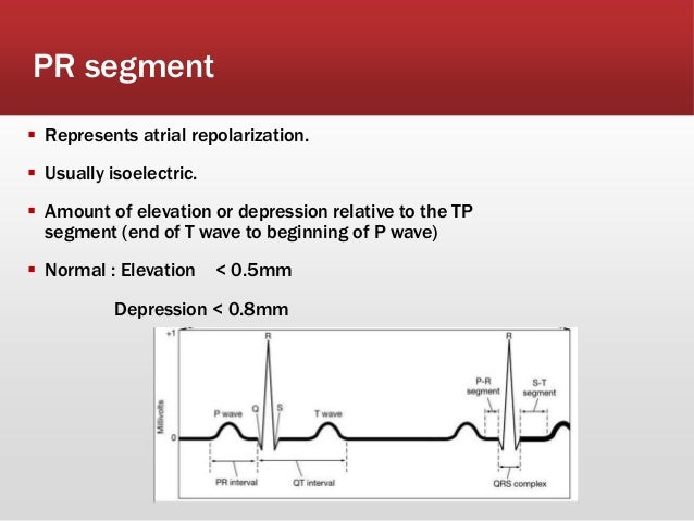 ECG BASICS AND ARRTHYMIAS