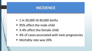 Prune belly syndrome | PPTX