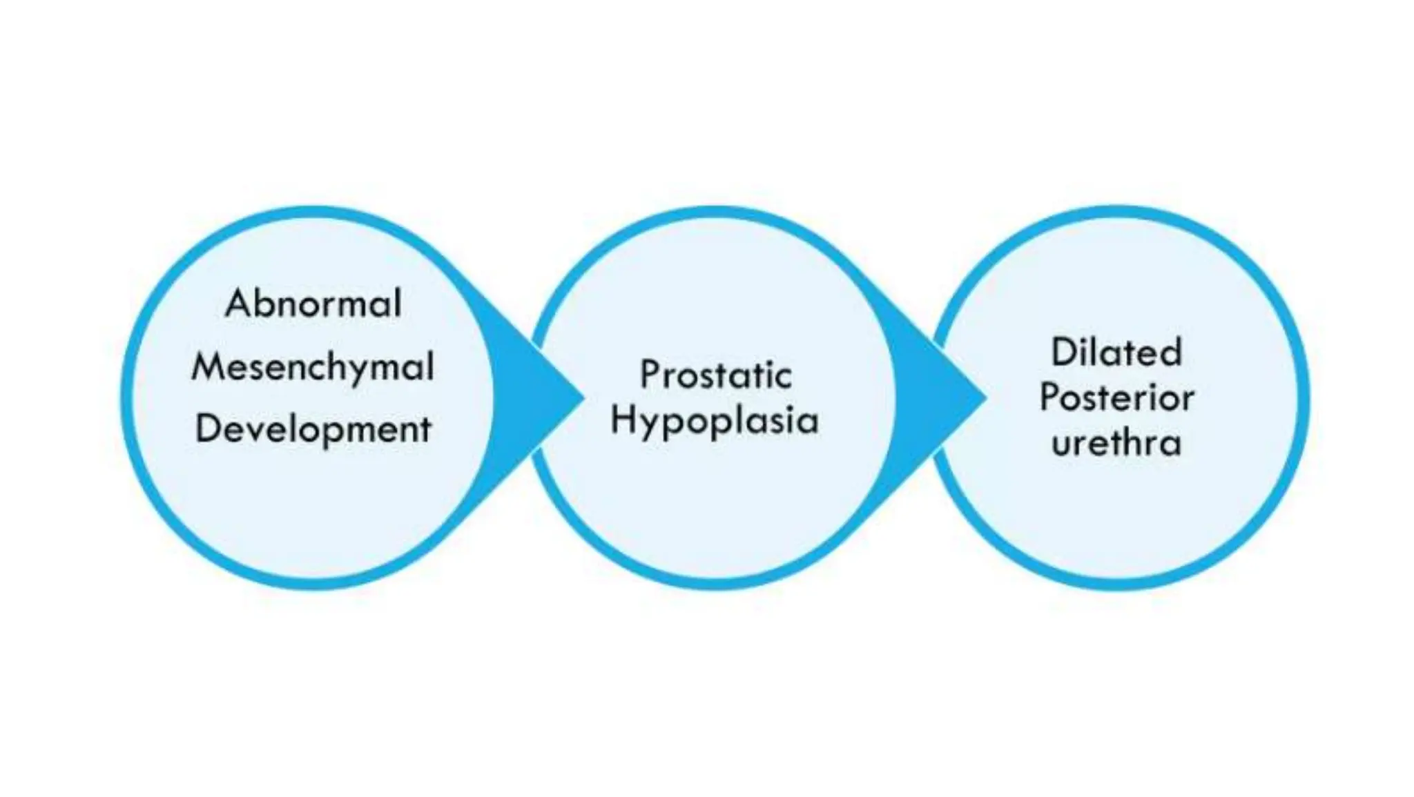 A ppt about the Prune Belly Syndrome.pptx
